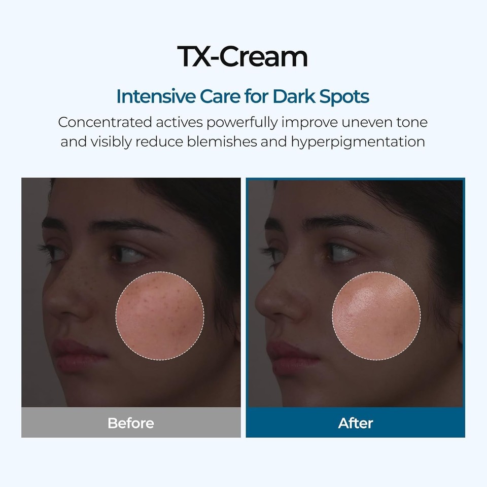 Dr.TX Cream Tranexamic Acid & Niacinamide Dark Spot Brightening ...