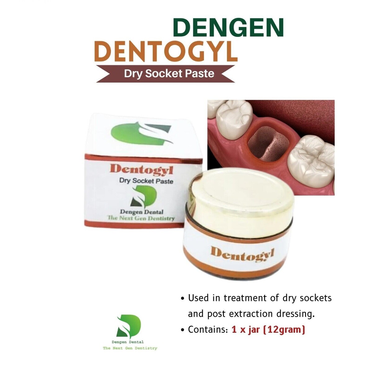 Dry Socket Treatment Prevest Denpro Alvocure For Dry Socket Treatment
