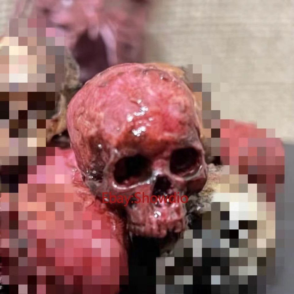 1/12 1/6 Scale Human Skeleton Half-body Flesh Blood Skeleton Model ...