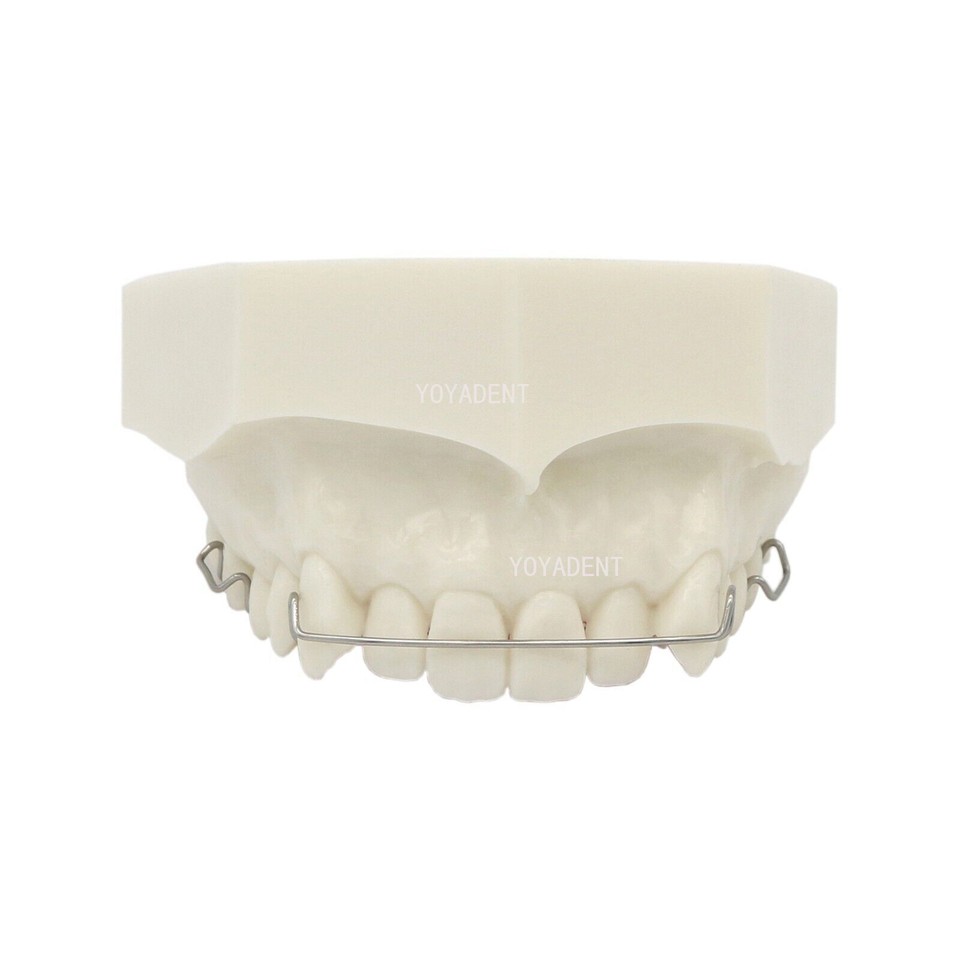 Dental Orthodontic Teeth Model With Metal Ceramic Brackets Tube Hawley ...