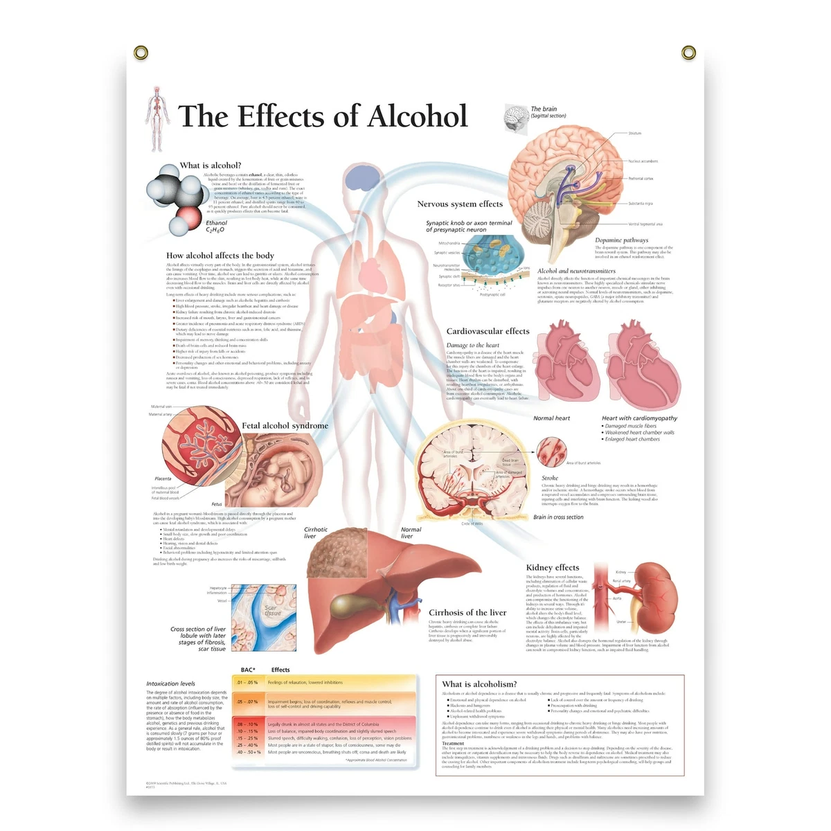 Brain On Alcohol Poster