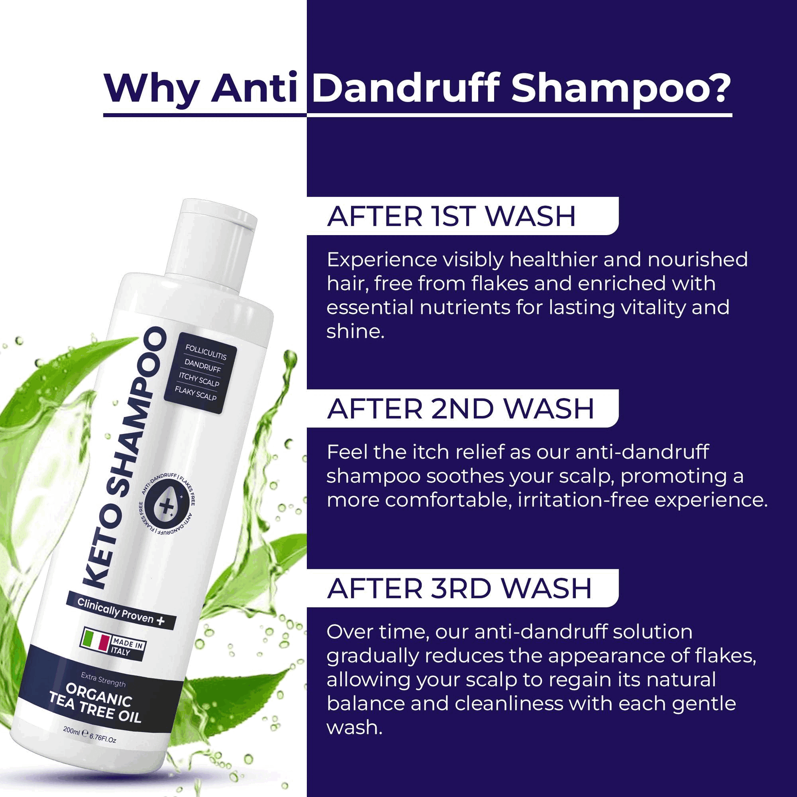 Anti Dandruff Shampoo pack 2 with Scalp Brush Sulfate Free Medicated ...