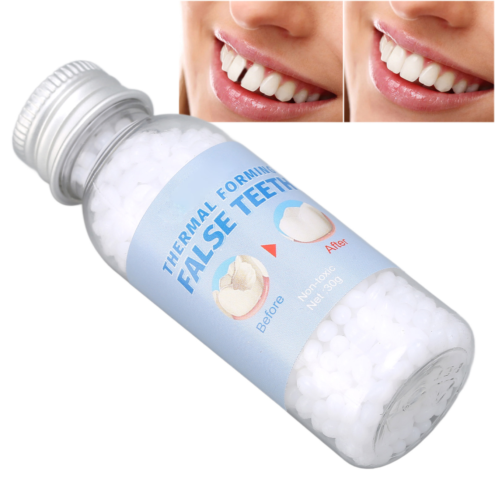 Tooth Repair Glue Safe Material Simple Operation Dental Care Glue Kit ...