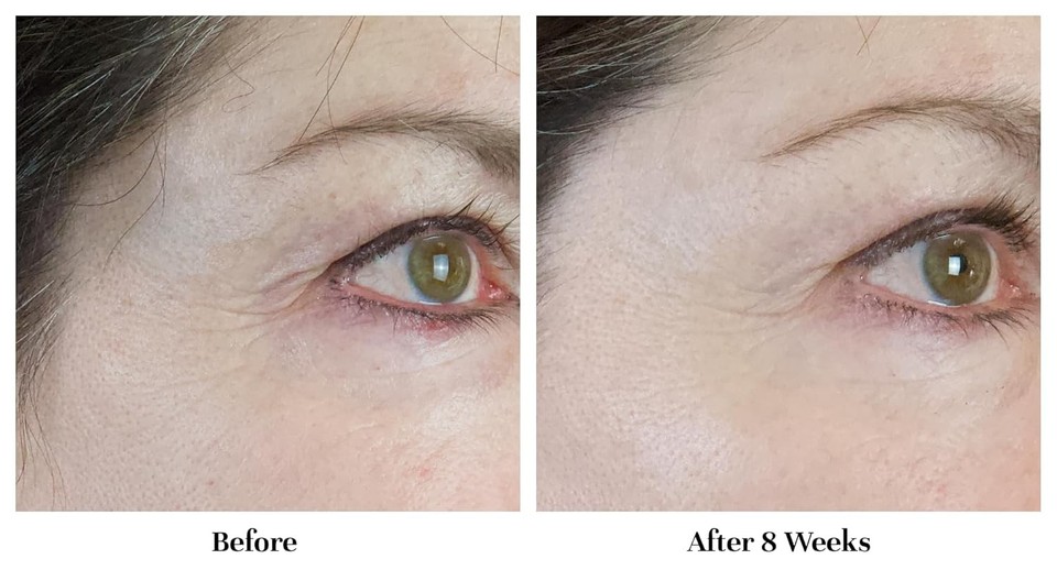 City Beauty Line-Blurring Wrinkle Filler – Spot Solution for Wrinkles ...