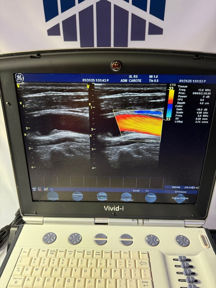 GE Ultrasound Vivid i BT12.2 2015. 3Sc-RS Cardiac & 8L-RS Probe . All Options On | eBay