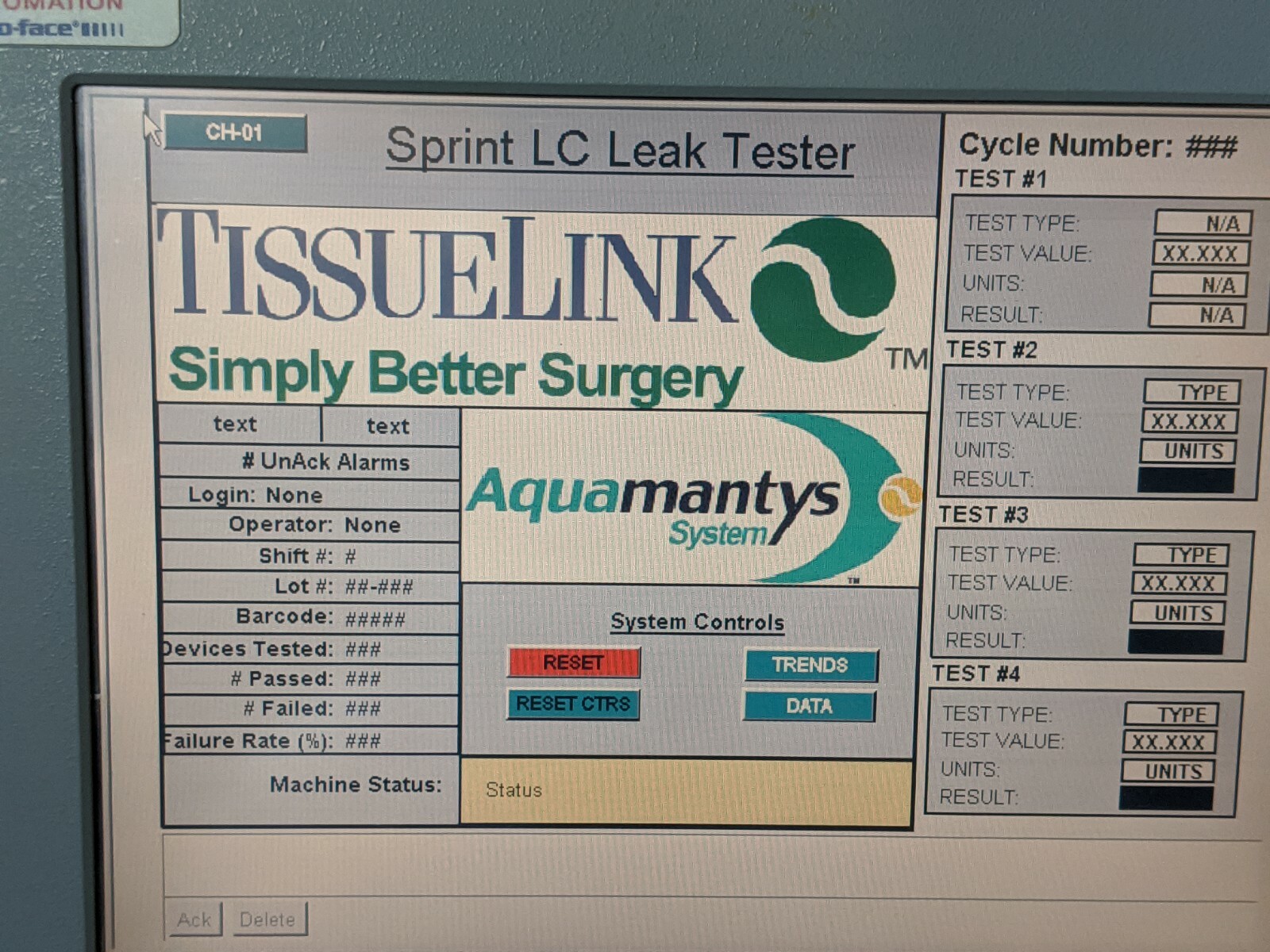 Aquamantys TissueLink Xycom Cimplicity Sprint LC Leak, HiPot ...