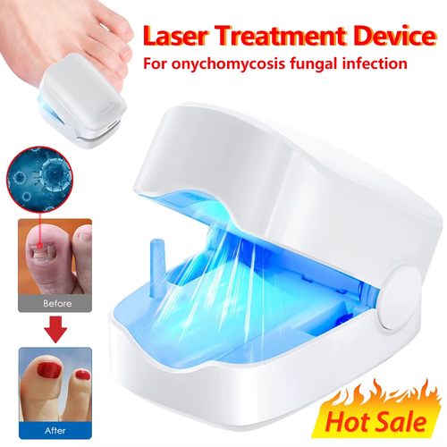 Nail Fungus Laser Therapy Device Onychomycosis Treatment for Fingers ...