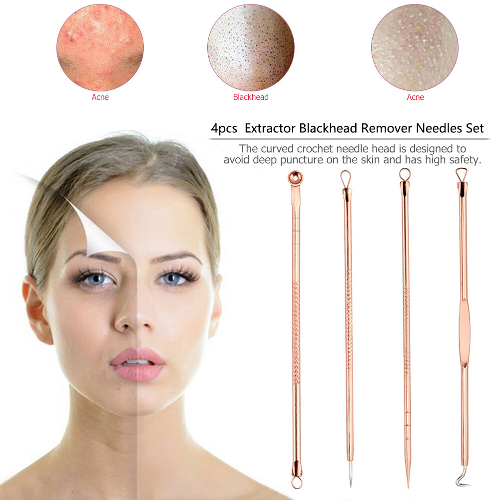AU Acne Needle Kit Stainless Steel Pimple Remover Pore Cleaner (Rose ...