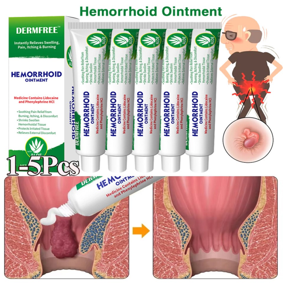 Hemorrhoids Remove Ointment Herbal Cream Relief Piles Pain Reduce ...