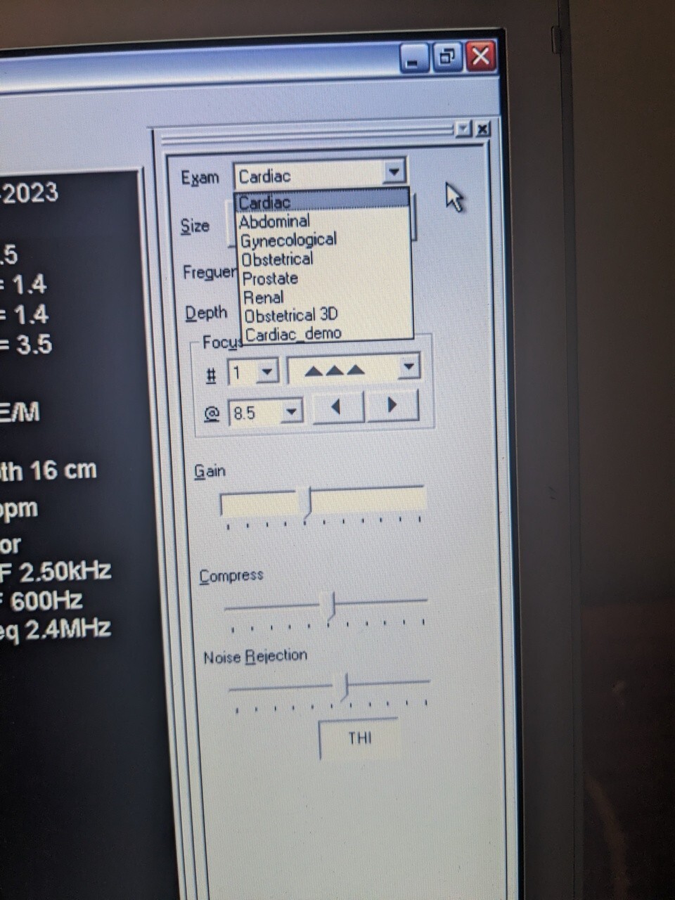 Siemens Acuson P50 Portable Cardiac Ultrasound with ECG Trigger + 4V2 ...