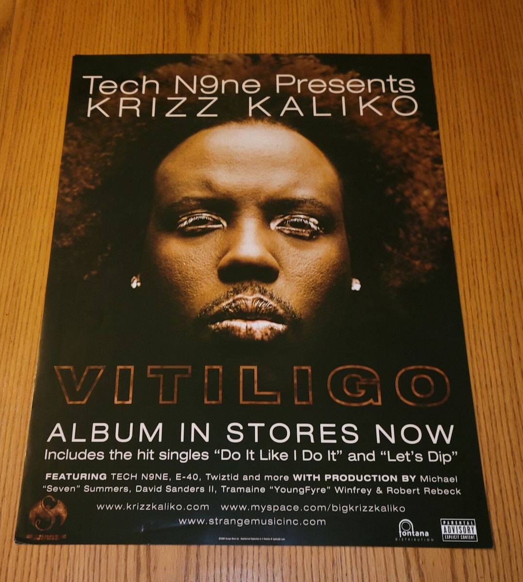 Krizz Kaliko Vitiligo 17 Famous People With Vitiligo Living Dappled