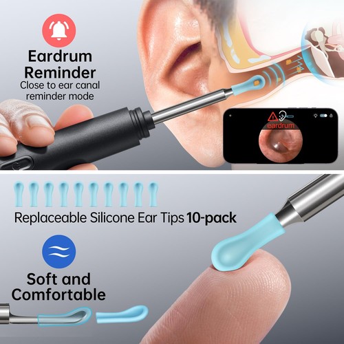 Ear Wax Removal Tool Camera, 1296P HD Camera and 6 LED Lights, Ear ...