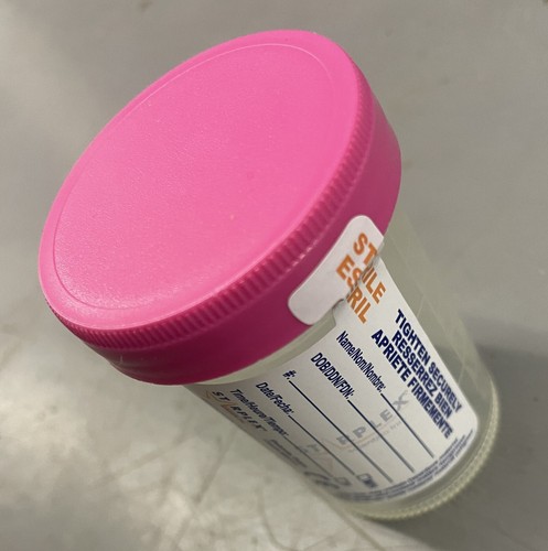 STARPLEX 03008-8 CLEAR URINE BOTTLE 90ML WATER PROOF SEAL PINK CAP 100 ...