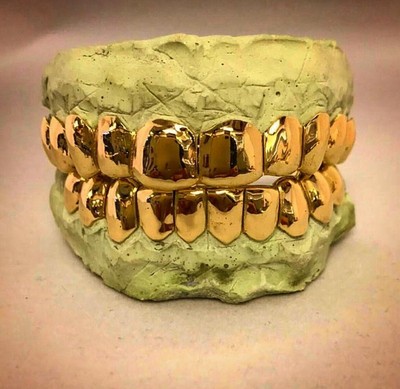 MA CUSTOM 6/6 14k REAL SOLID GOLD PERM CUT GRILLZ | eBay