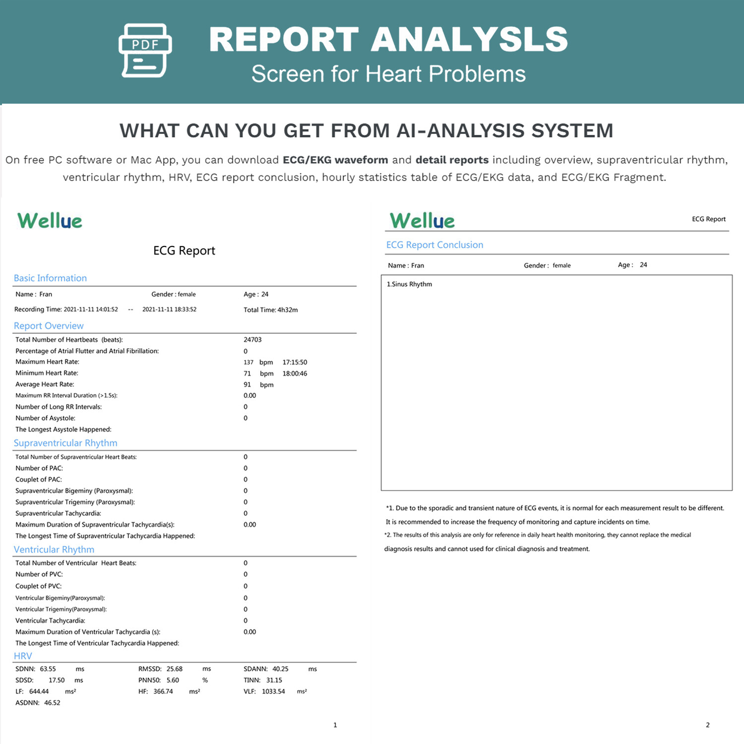 24h Holter Monitor ECG Recording Detailed Reports by AI Analysis US ...