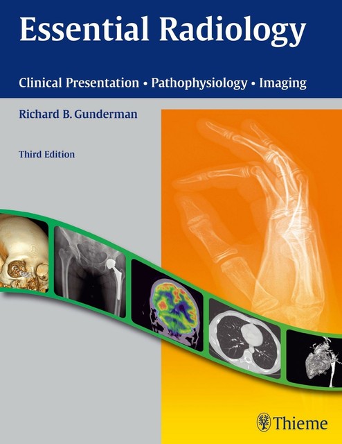 Essential Radiology von Richard B. Gunderman (2014, Taschenbuch) for ...