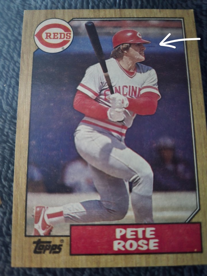 1987 Topps - #200 Pete Rose - Rare Multiple Errors On Card with Pink | eBay