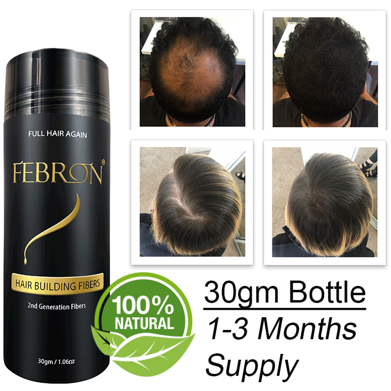 FEBRON Hair Building Fibers 30gm - For Thinning Hair Cover Bald spots ...