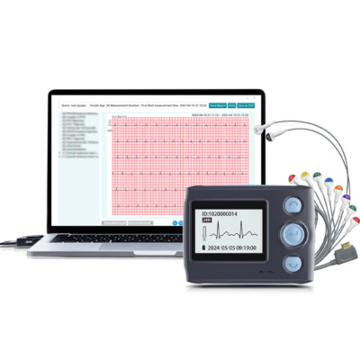 12 Lead Holter Monitor Recording 24h ECG and Heart Rate AI Analysis ...