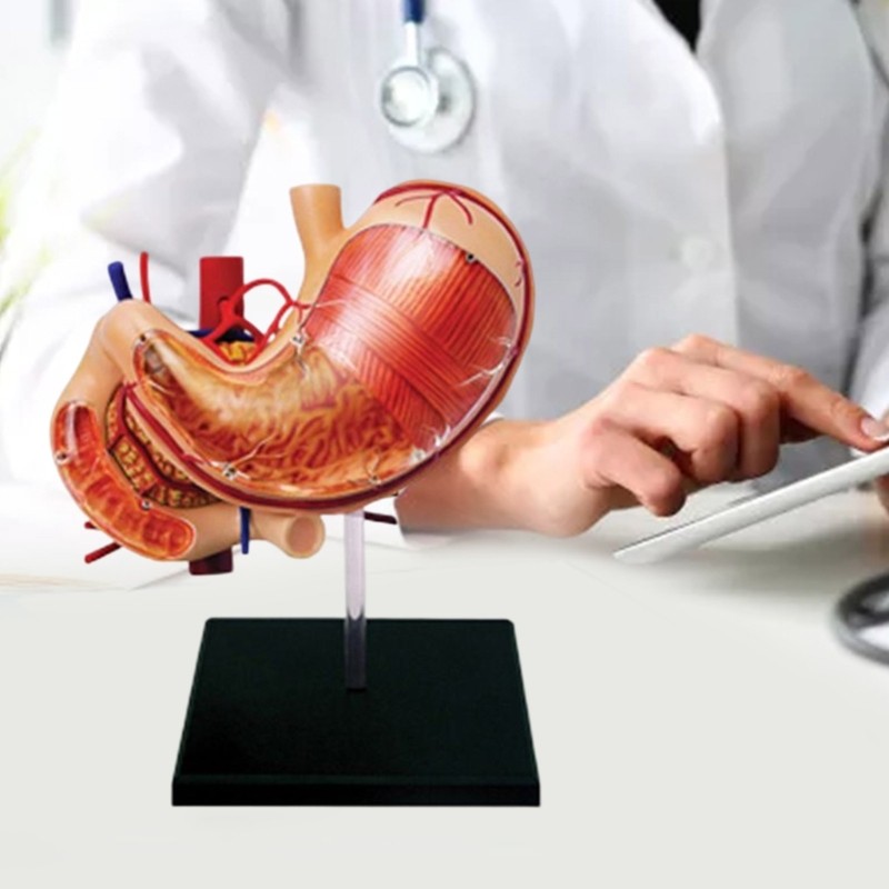 Human Stomach &Pancreas Anatomy Model Removable Human Organs Model ...