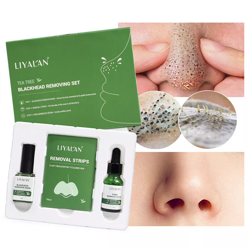 Blackhead Nose Removal