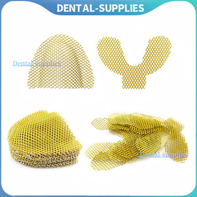 Dental Denture Reinforcement Mesh Metal Palatal Reinforcement Mesh ...