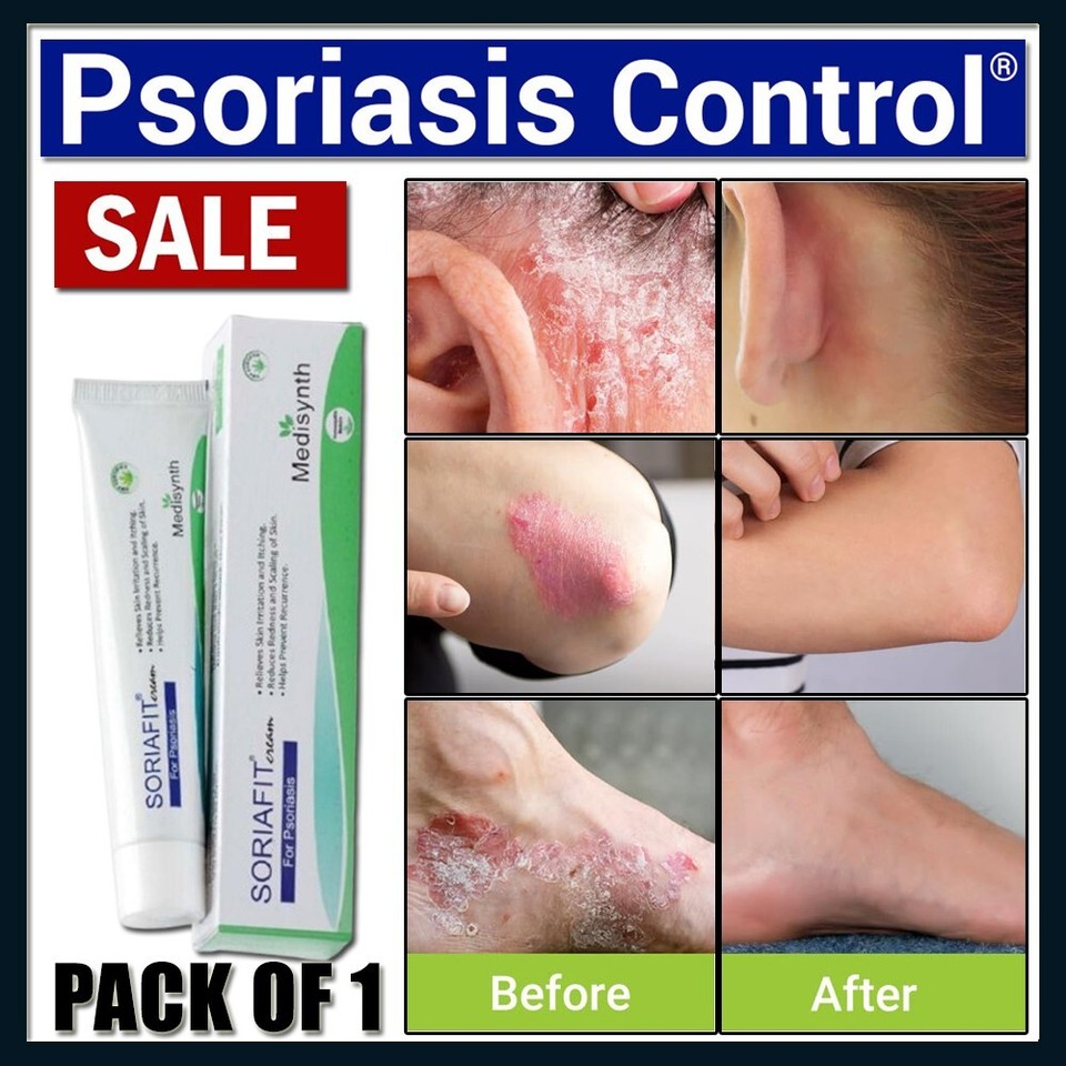 Crema Para Dermatitis Eczema Psoriasis Para Comezon Picazon Ronchas ...
