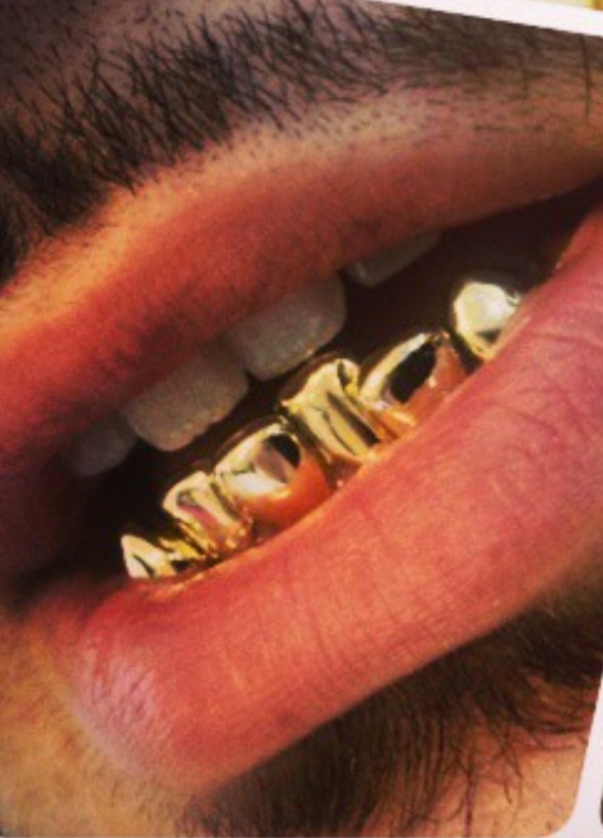 14k Solid Gold Grills With Deep Cut/Permanent Looking 6 Top Custom Fit ...