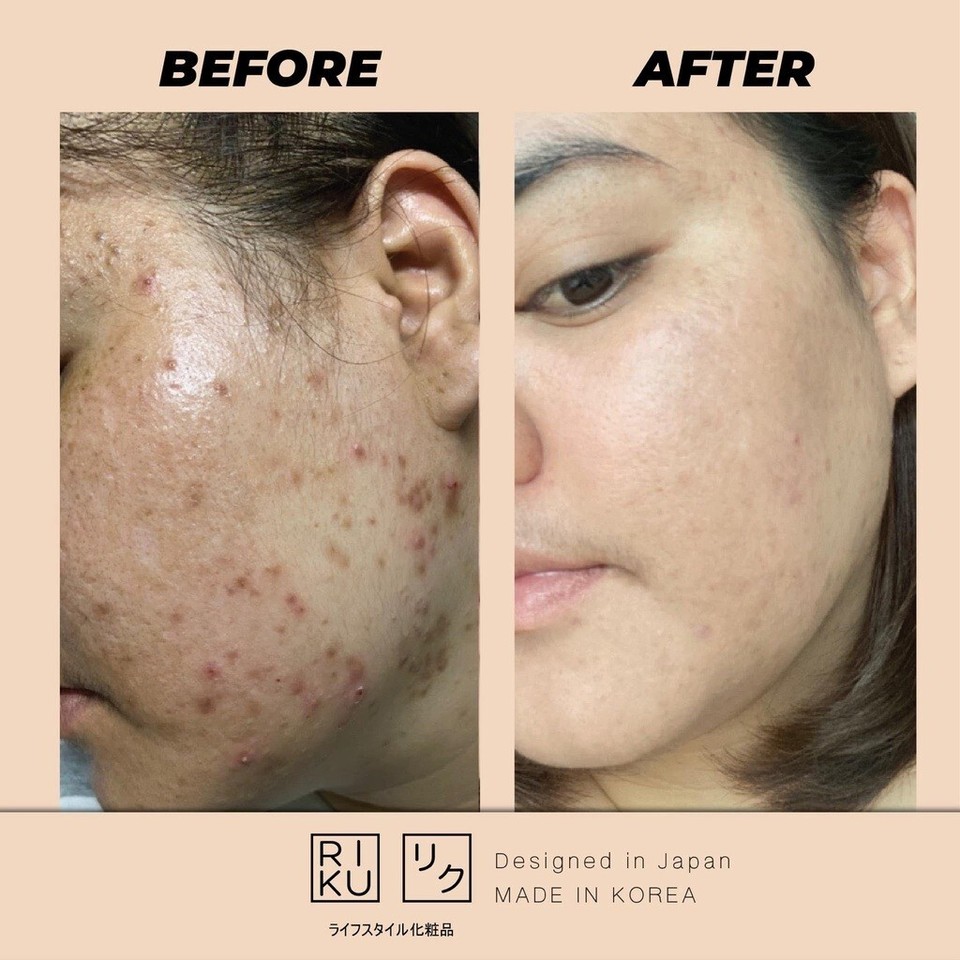 RIKU Organic Rice Serum Boost skin moisture Strong healthy Anti dark ...