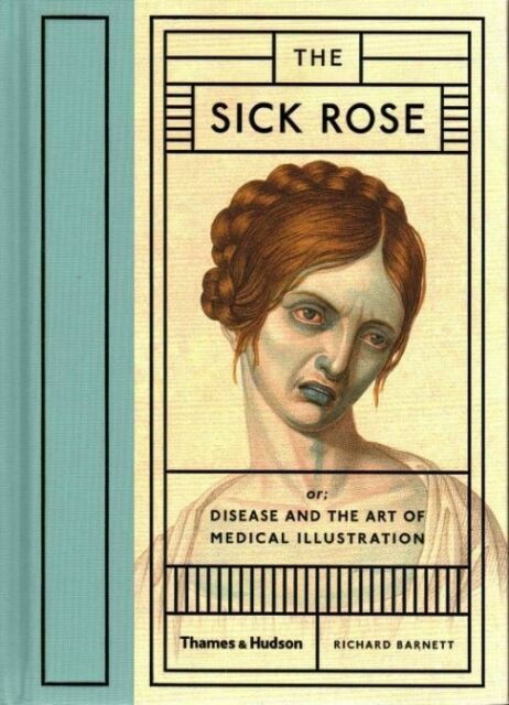 Sick Rose Disease in The Golden Age of Medical Illustration Album ...