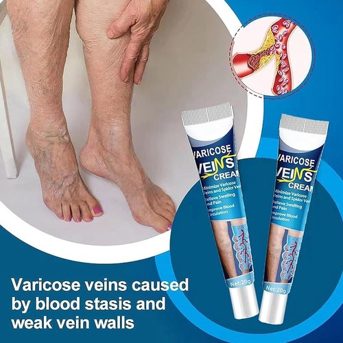 Mucopolysaccharide Polysulfate Cream, Varicose Veins Cream, Legs Care ...