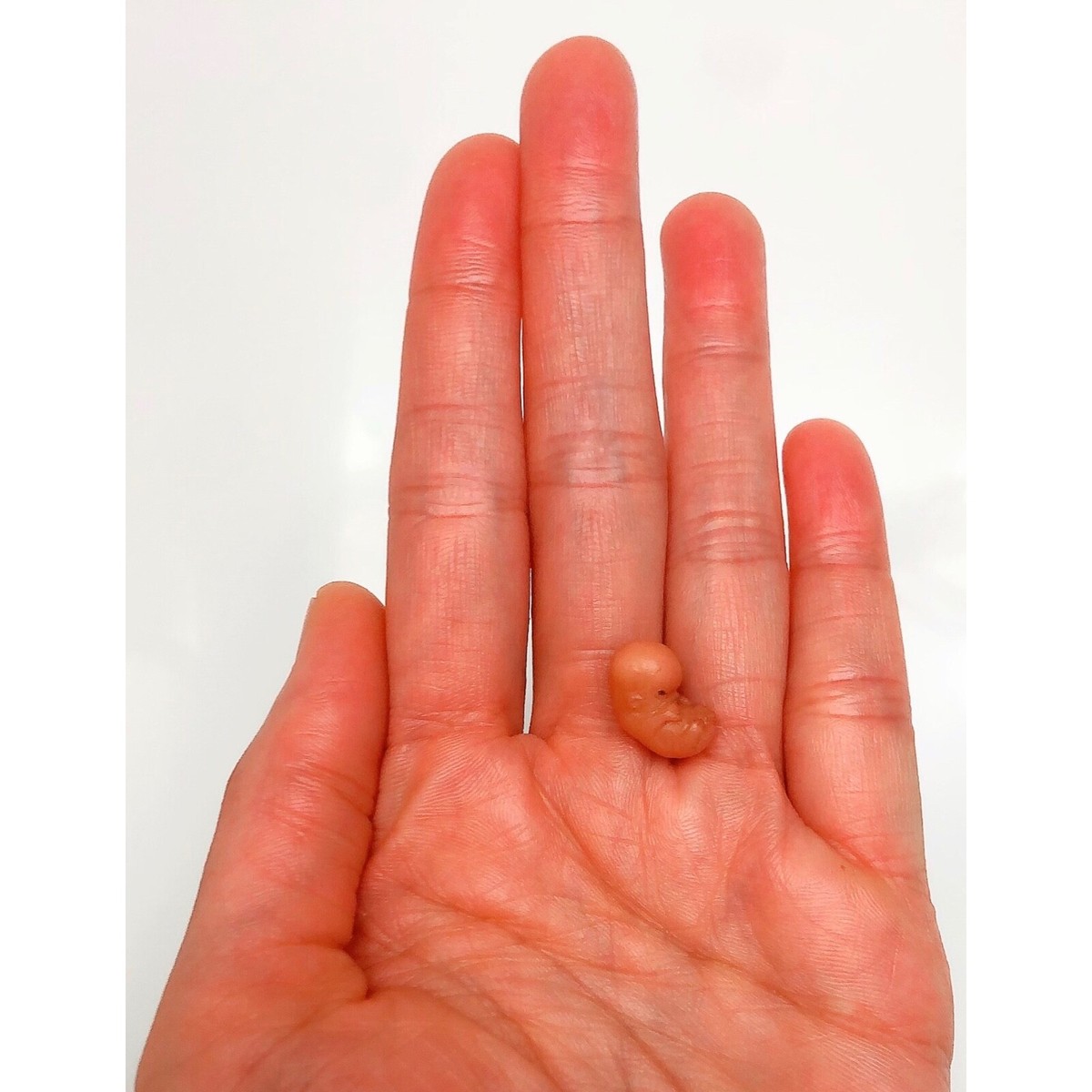 What Looks Like A 6 Week Fetus