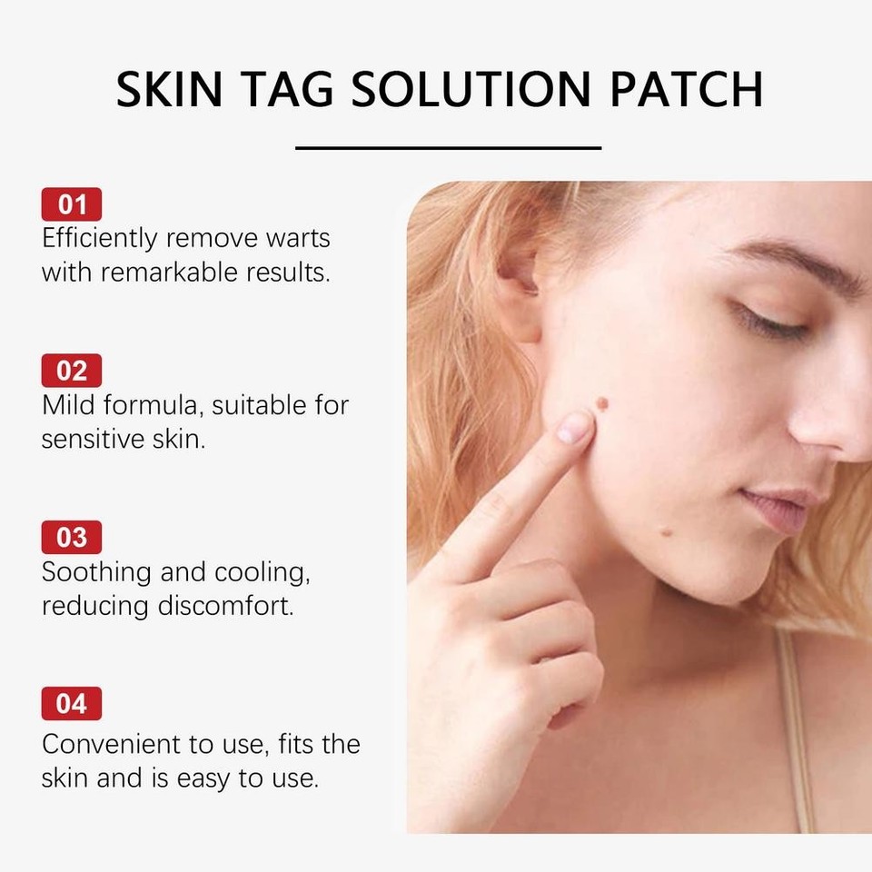 MICRONEEDLE BOTANIC Skin Tag & Acne Patch Skin Tag Remover Patches 9Pcs ...