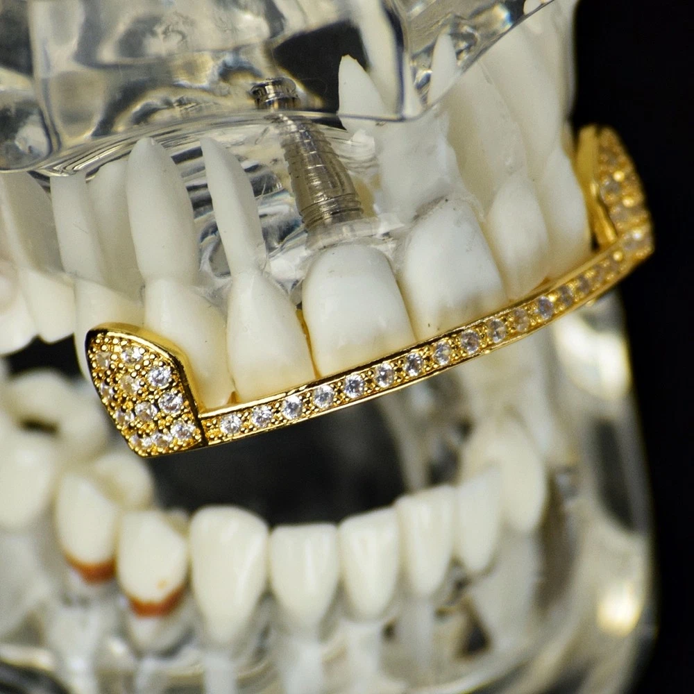 Custom Grillz with Front Bar - glwec.in