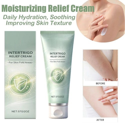 Intertrigo Relief Cream for Skin Fold Areas, Skin Wrinkle Cream IN ...