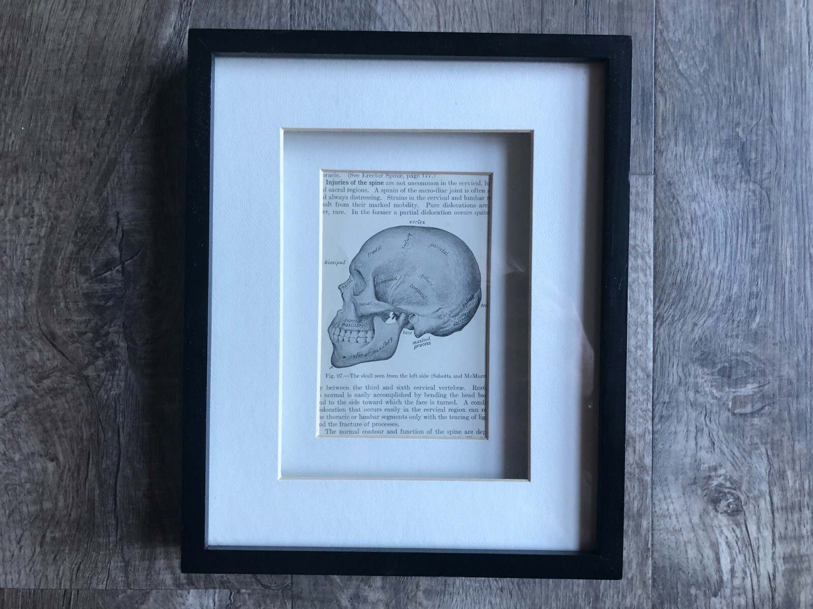 MEDICAL SCIENCE ODD: Framed Skull Medical Plate Anatomy and Physiology ...
