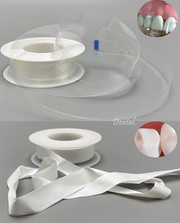 Dental Polyester Film Teflon Matrix Bands Strips Contoured Matrices 0. ...