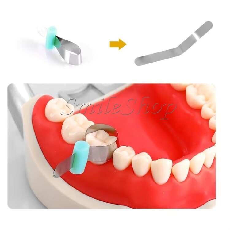 Sheet Lock Dental Forming Sheet Matrix Bands Ring Clip Sectional ...