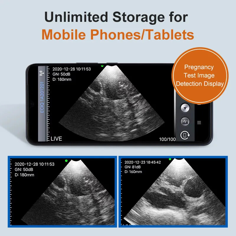 Wireless Veterinary Ultrasound Scanner Pregnancy Test Machine Pig Sheep ...
