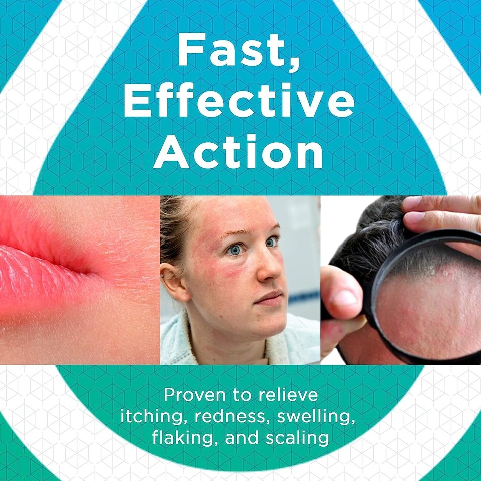 Dermoscribe - Seborrheic Dermatitis Cream, Eczema Cream, Fast-Acting ...