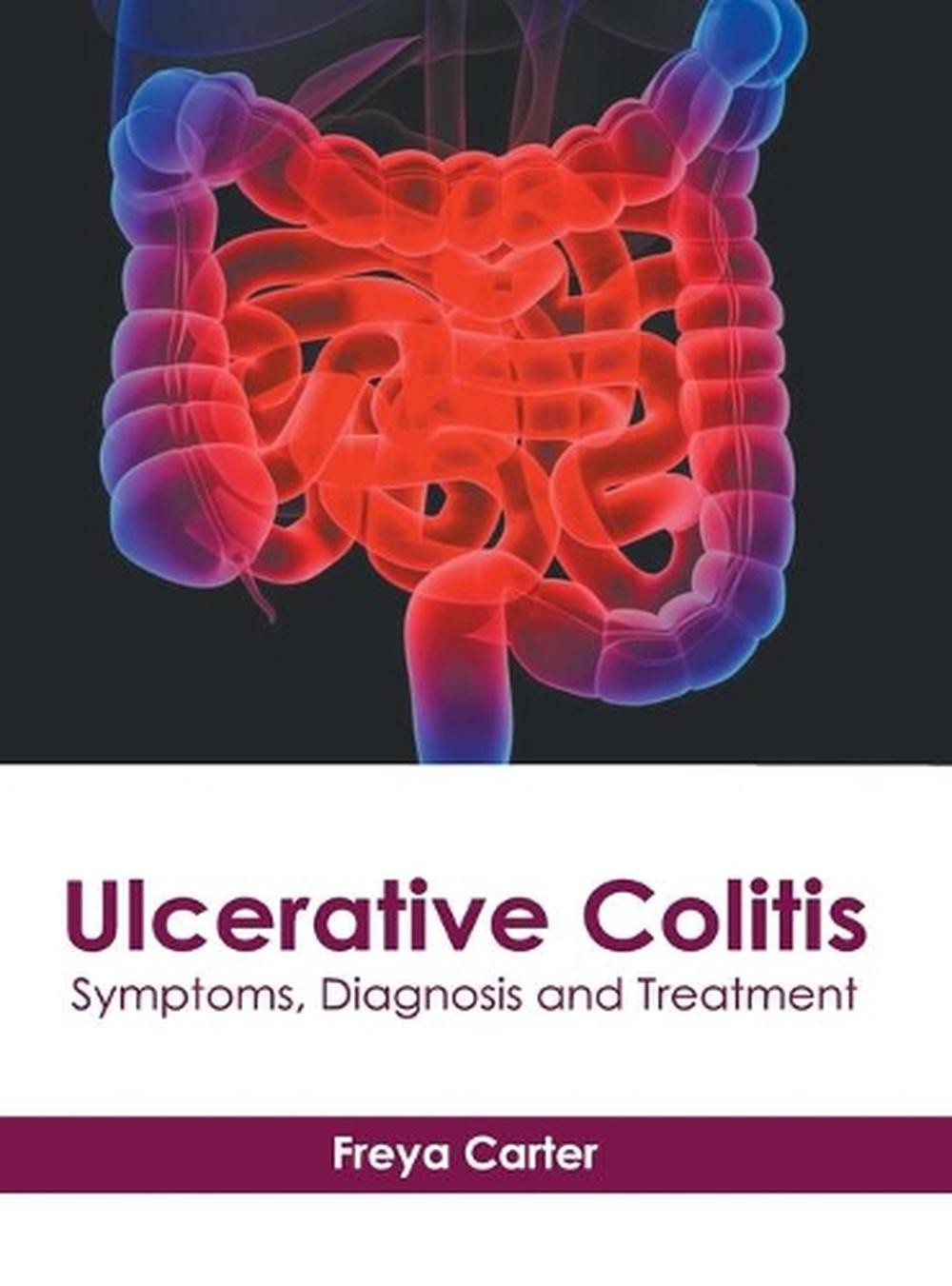 Ulcerative Colitis: Symptoms, Diagnosis and Treatment by Freya Carter ...
