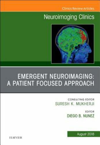 The Clinics: Radiology Ser.: Emergent Neuroimaging: a Patient Focused ...