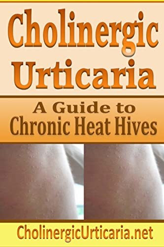 Cholinergic Urticaria: A Guide to Chronic Heat Hives By B Page ...