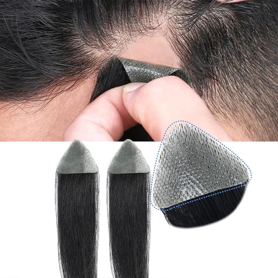 Temple Hair Patches Human Hair Pieces Skin Base Cover-Up Frontal ...