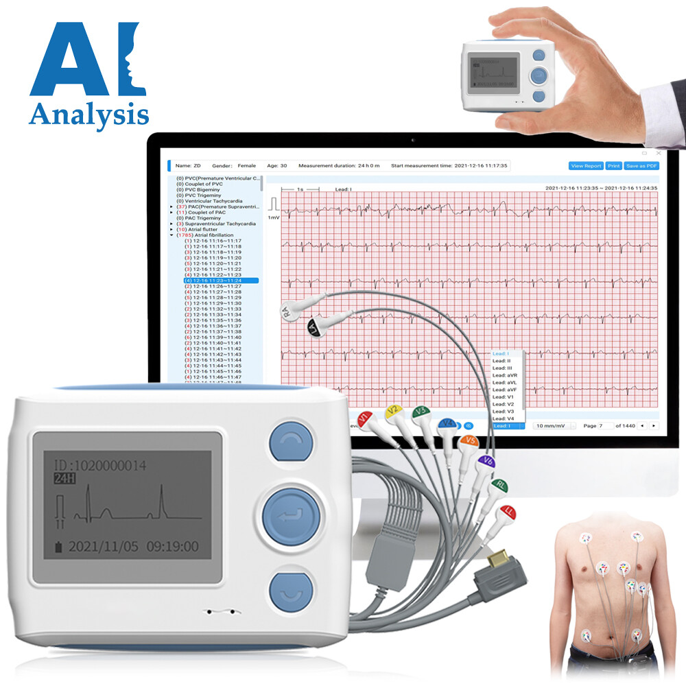Ventricular Fibrillation Monitor