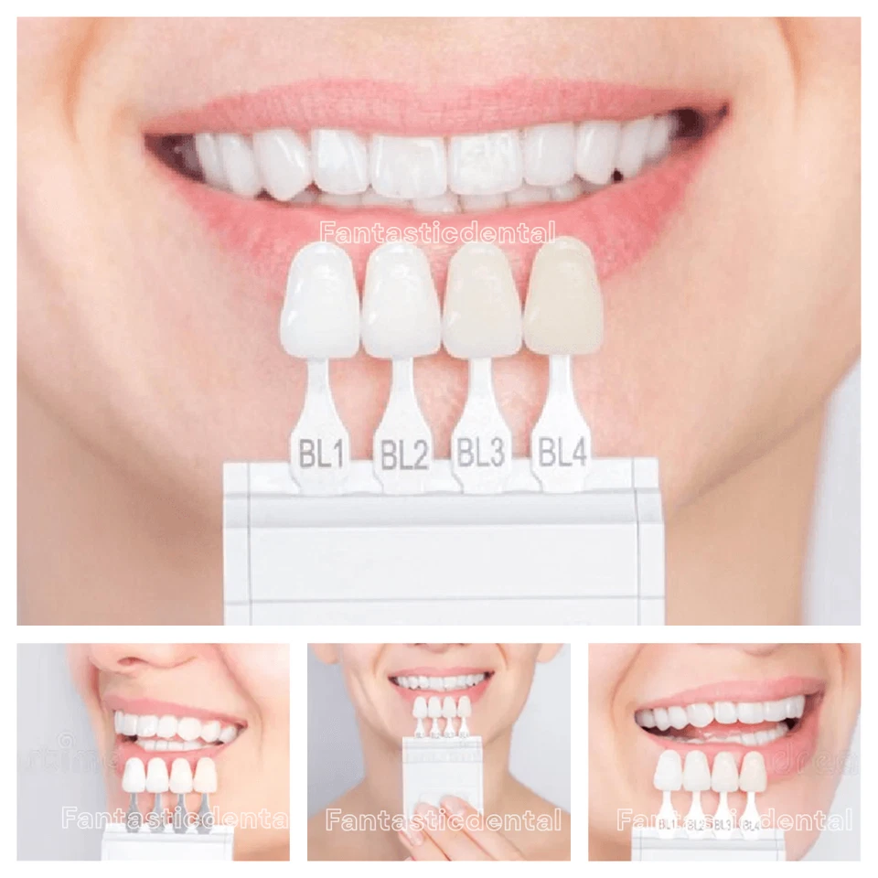 Dental Bleach Shade Guide BL1 4Colors Bleached Chart Teeth Based Vita ...