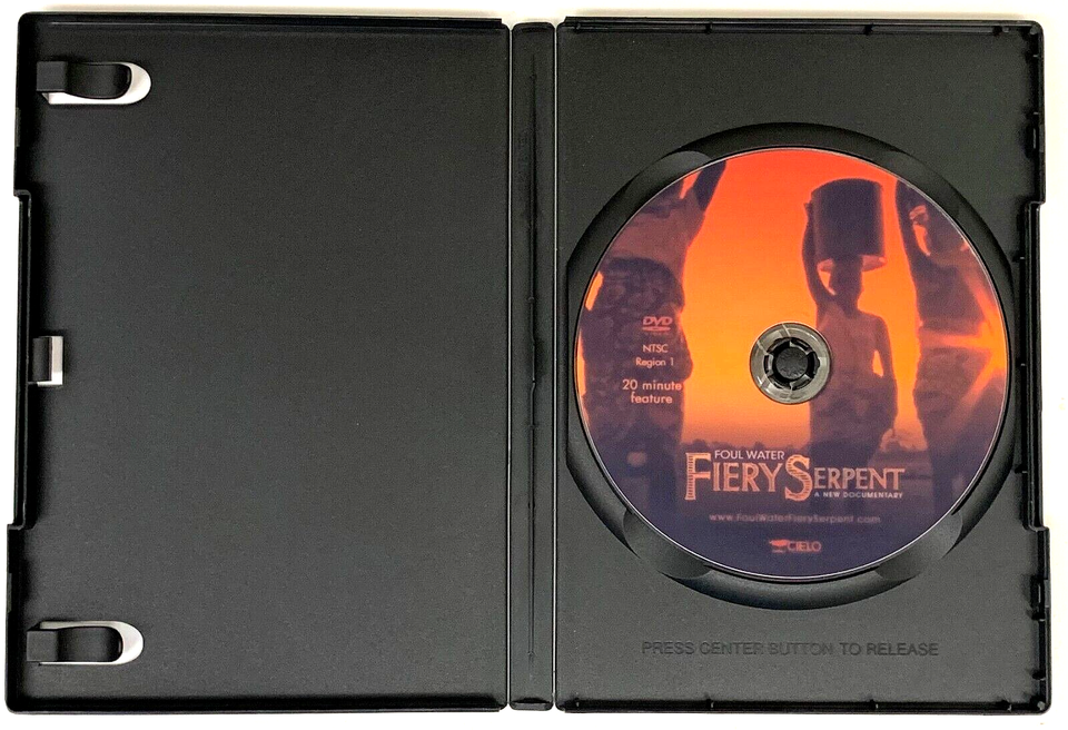 FOUL WATER FIERY SERPENT Guinea Worm Documentary DVD Parasite Africa ...