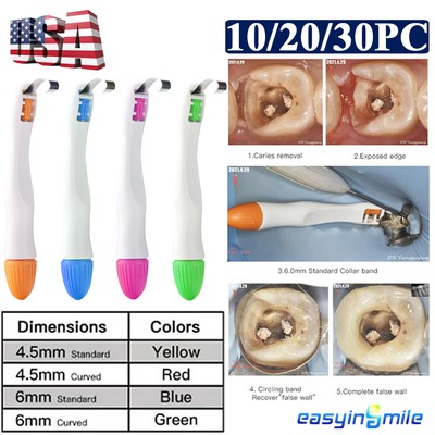 Adjust Dental Pro Matrix Bands Molar/Premolar Restoration Pre Formed 10 ...