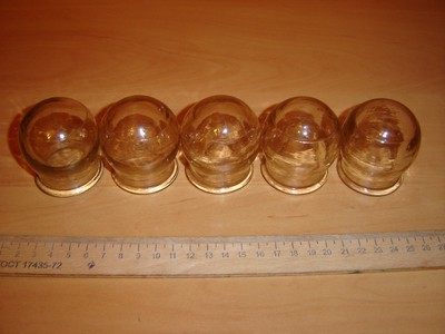 Lot of 5 Antique Medical Phlebotomy Blood Letting Bleeding Cupping ...