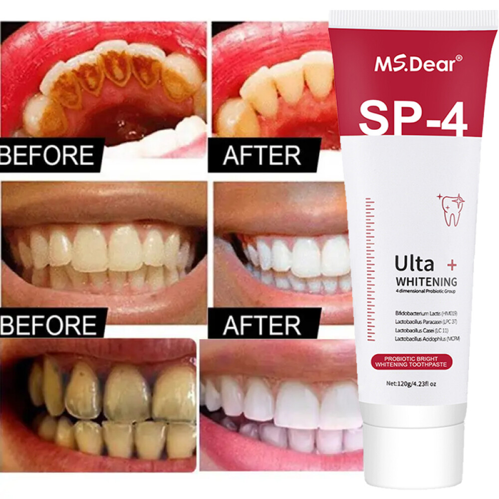 2x SP-4 Probiotic Toothpaste, Sip-4 Toothpaste Ultra Whitening, Shark ...